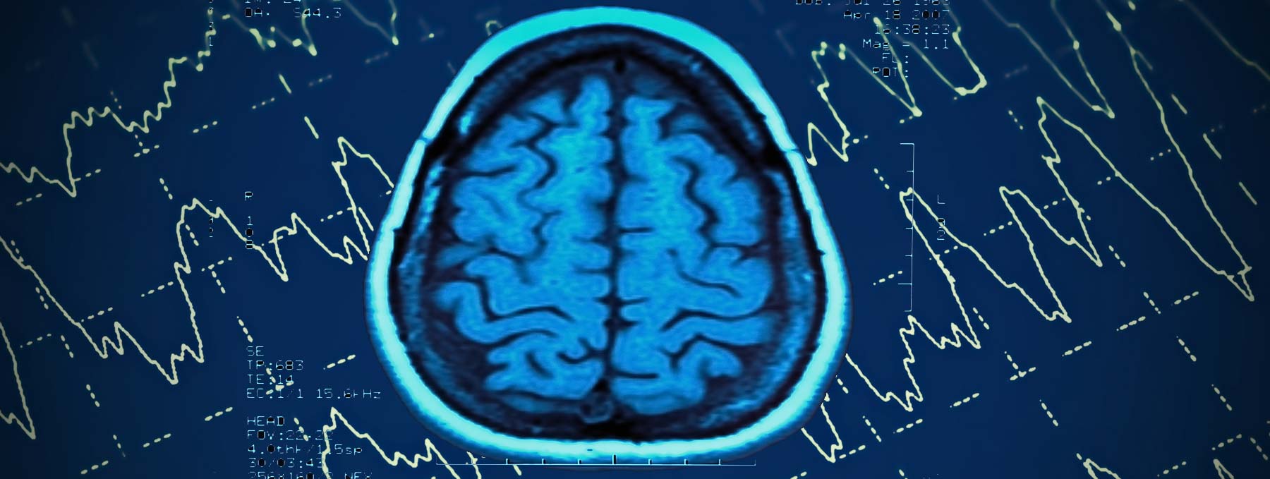 The Basics of Your Sleep Cycle – Chronobiology.com