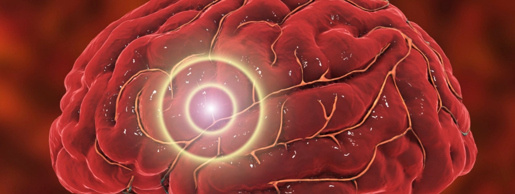 Deep Sleep: A Powerful Weapon Against Brain Disorders? – Chronobiology.com