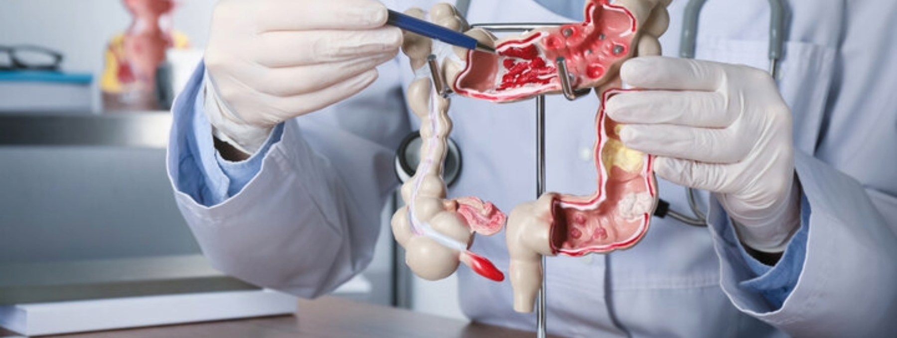 Can Circadian Disorders Accelerate the Progression of Colorectal Cancer ...